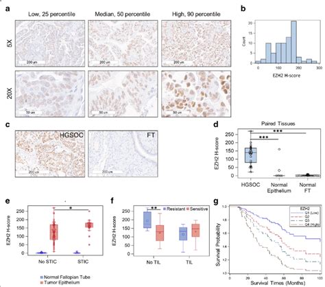 A Immunohistochemical Ihc Expression Of Ezh2 In Low Median And