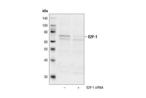 E2f 1 Antibody Cell Signaling Technology