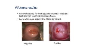Cervical Cancer Screening Modalities Pptx