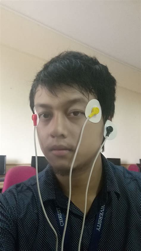 2 Electrooculogram Electrode Placements 17 Download Scientific Diagram