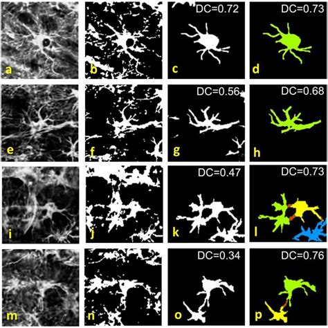 astrocyte detection performance left representative images from set