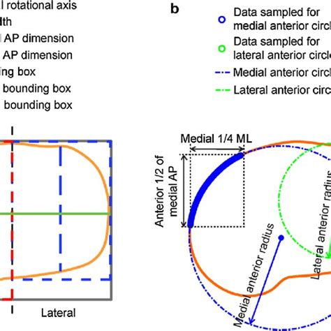 A Representative Tibia With The Two Types Of Component Placement For Download Scientific