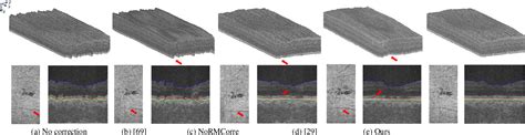 Simultaneous Alignment And Surface Regression Using Hybrid 2d 3d