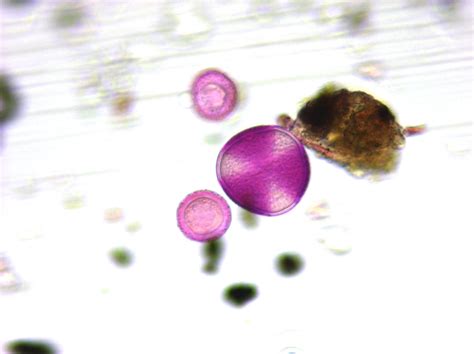 Forsyth County Nc Pollen This Graphic Shows The Daily Predominant