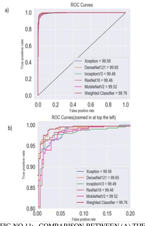 Figure 10 From A Deep Feature Learning Model For Pneumonia Detection Applying A Combination Of