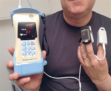 51 Year Old Asymptomatic Male Patient With Unremarkable Appearance No Download Scientific