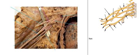 Brachial Plexus Terminal Branches Diagram Quizlet