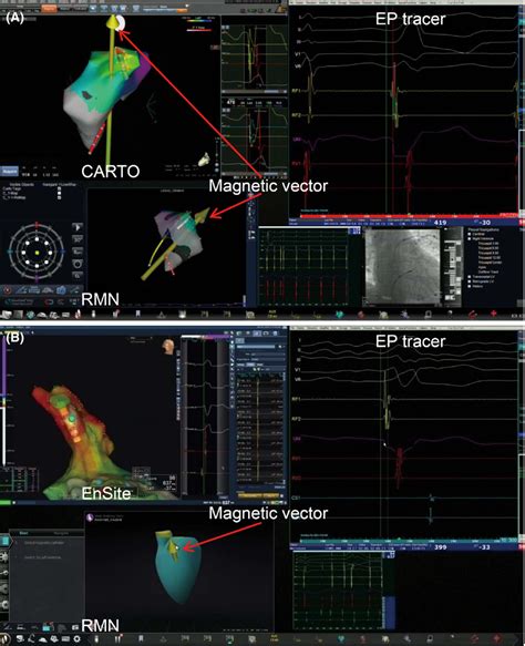 The Interface Of Odyssey System A Carto Mapping System And Download Scientific Diagram