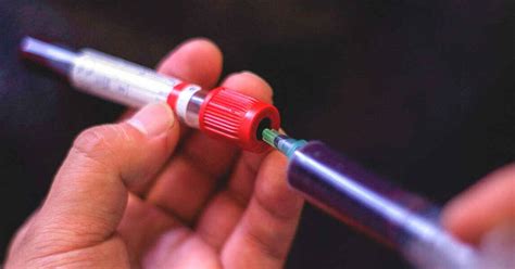 Mchc Blood Test What Is Mchc In Blood Test Why And When Its Is Done