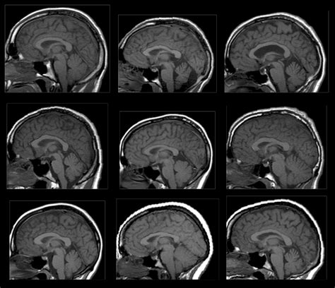 The Structure Of FMRI Data FMRI Image Preprocessing