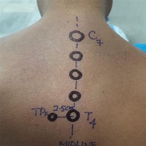 Surface Landmarks For The Esb Download Scientific Diagram