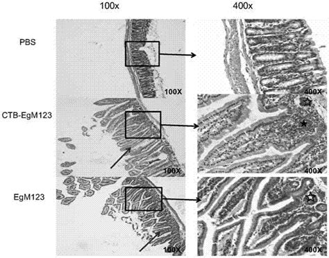 Vaccine For Blocking Transmission Of Echinococcosis Pathogeny