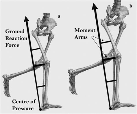 Femur And Tibia