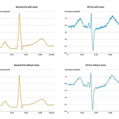 Pdf Application Of Deep Convolutional Neural Network For Automated