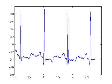 Load Mit Bih Arrhythmia Ecg Database Onto Matlab Stack Overflow