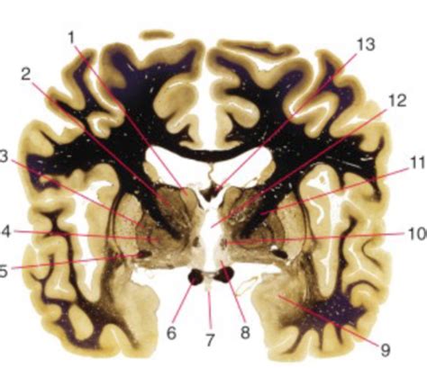 Cerebrum In Cross Sections Flashcards Quizlet