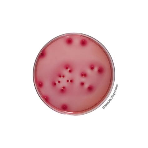 Desoxycholate Lactose Agar Innovation Diagnostics