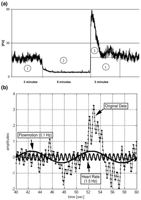 Principles Of Measurement Of Reactive Hyperaemia And Flowmotion Using Download Scientific