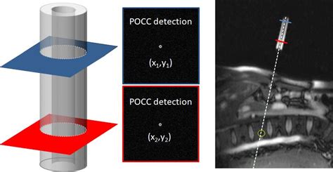 Interventional Mri Universitätsklinikum Freiburg