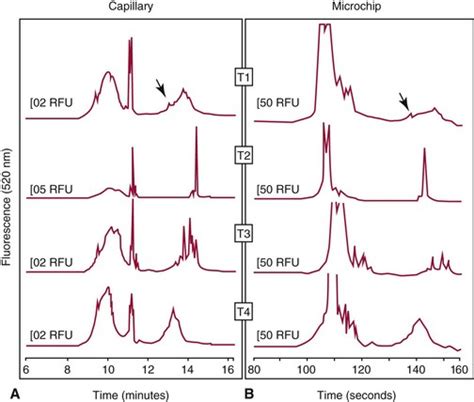 Microfabrication And Microfluidics And Their Application To Clinical Diagnostics Basicmedical Key