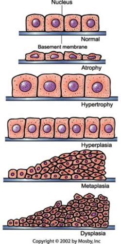Cellular Adaptation Flashcards Quizlet