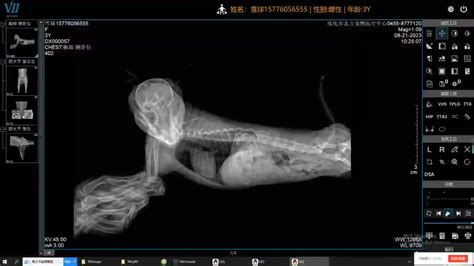 Digital Radiography Dynamic X Ray Machine Portable Xray Equipment Buy