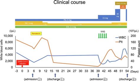 Sars Cov 2 Infection Induced Immune Thrombocytopenia In A Patient With