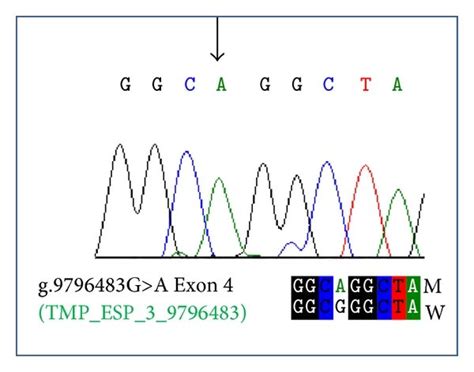 Sequencing Electropherogram Of Polymorphisms Of Ogg1 A B C Download Scientific