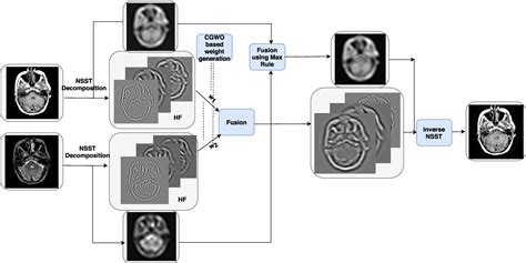Figure 1 From Multi Modal Medical Image Fusion With Adaptive Weighted