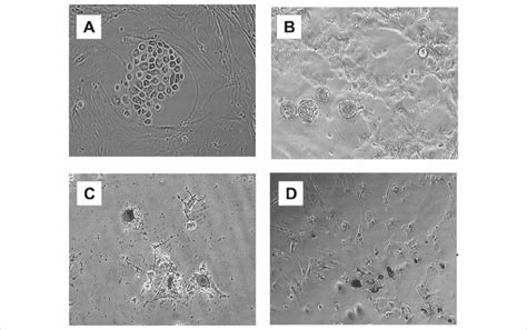 Photomicrograph Of Islet Cell Neogenesis A Ductal Epithelial