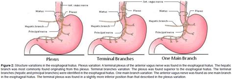 Anatomy Physiology Esophageal Hiatus