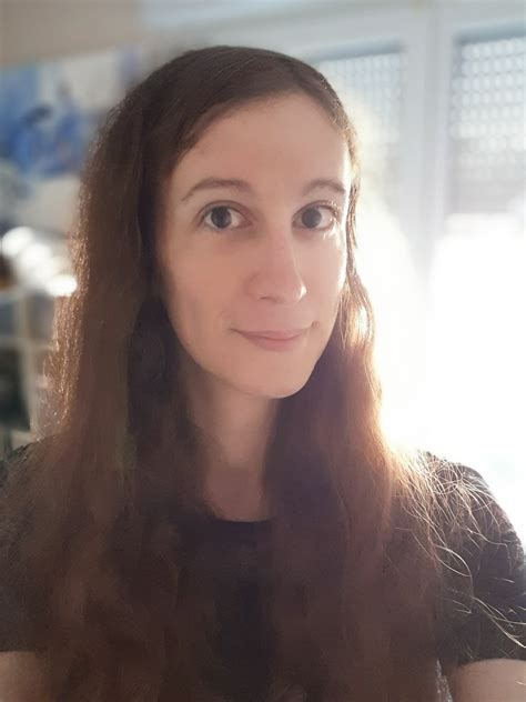 MTF Years HRT FFS Rhinoplasty R Transpositive