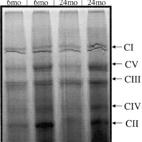 Separation Of Electron Transport Complexes Download Scientific Diagram