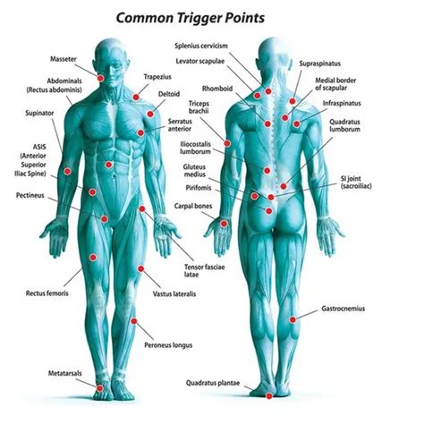 Trigger Point Injections In Tampa Bay Area St Petersburg