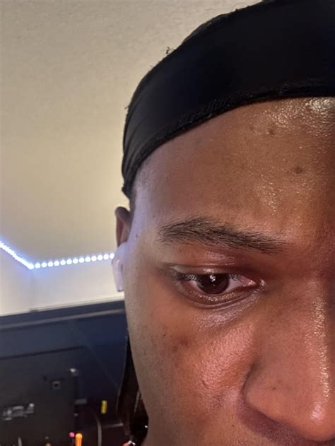 Routine Help Dark Skin Hyperpigmentation Men I Have Dark Spots I Am Trying To Get Rid Of And