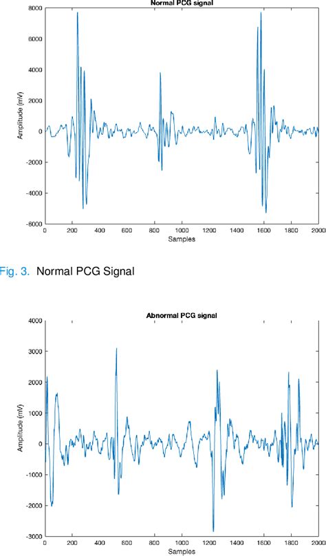 Figure 3 From A Peak Detection Algorithm For Localization And
