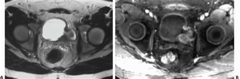 The Urinary Bladder Radiology Key