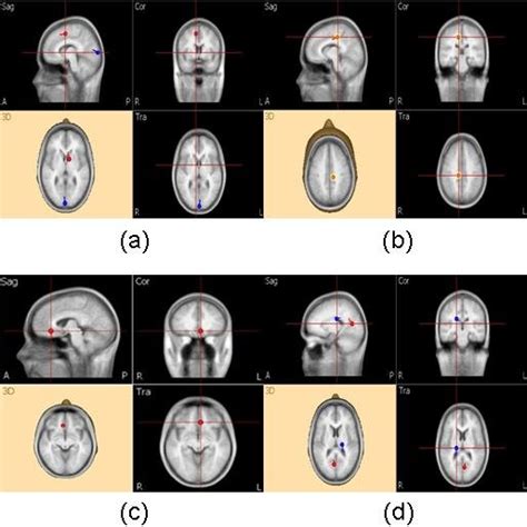 Pdf Spatio Temporal Brain Dynamics Of Understanding Social Versus Private Intentions An