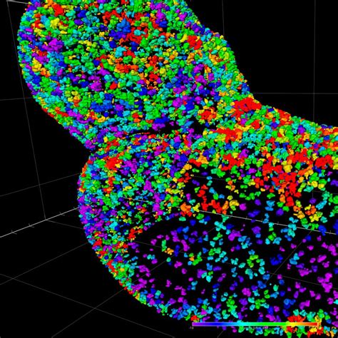 Ai Deeplearning Imageanalysis Vem Fibsem Imaging Microscopy Fromimagetoresults