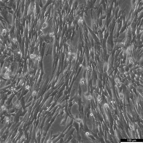 Bhk 21 Clone 13 Cells