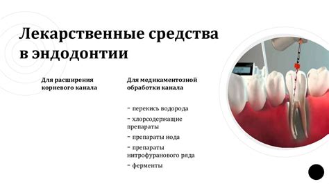 Медикаментозные методы обработки корневых каналов - презентация онлайн
