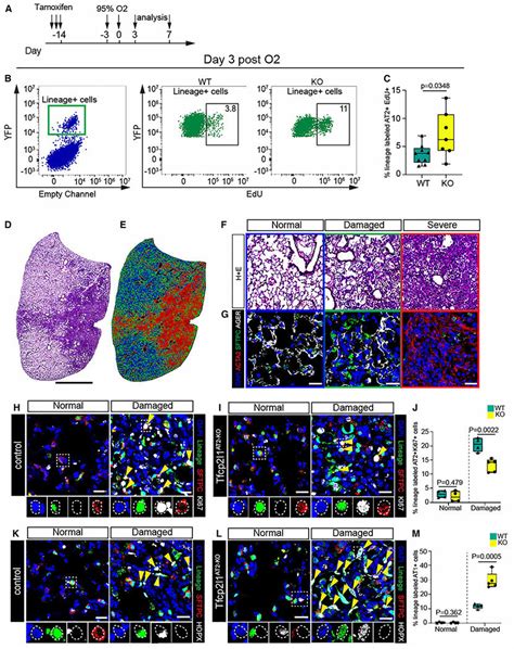 Tfcp2l1 Regulates At2 Cell Mediated Alveolar Regeneration In A Spatial