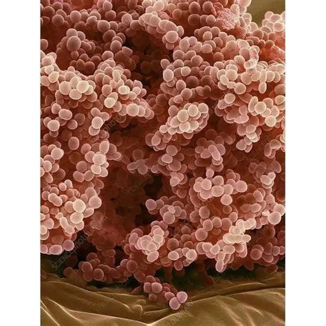 Lactococcus Species In Milk Kefir Grains Beneficial