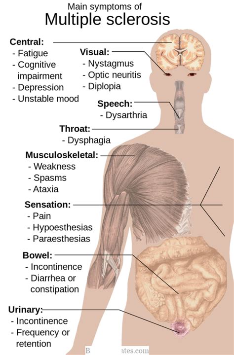 Diferença entre ALS e MS ALS vs MS Saúde