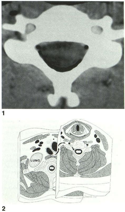 Structure Of Prevertebral Layer Of Cervical Fascia Semantic Scholar