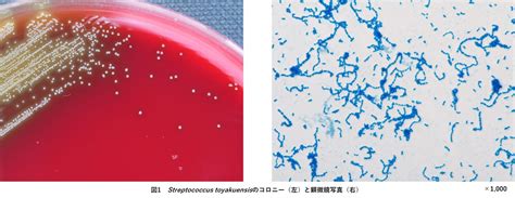 科學研究 東京藥科大學發現具有多重抗藥性的新種鏈球菌，命名為streptococcus Toyakuensis 客觀日本