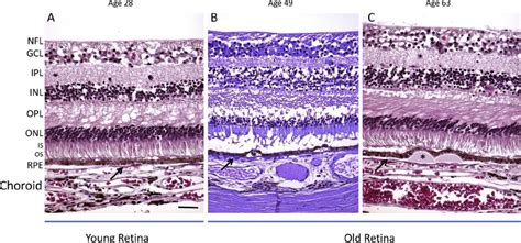 Histological Depiction Of Young And Old Retinas In The Young Image Of
