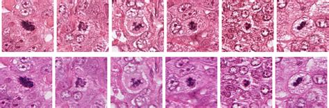 Figure 3 12 From Automated Mitosis Detection In Color And Multi Spectral High Content Images In