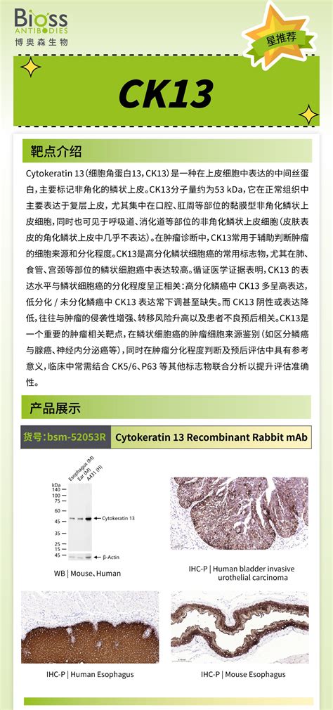 Bioss 星推荐 Ck13 抗体 公司新闻 北京博奥森生物技术有限公司