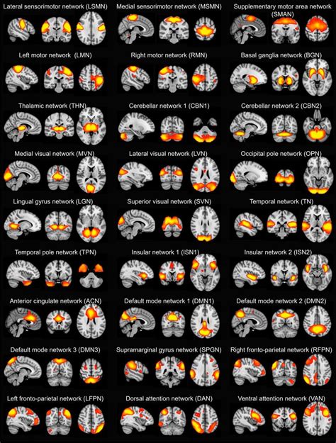 fig ure 1 spatial maps of the 27 resting state networks rsns obtained
